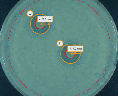 Singer Instruments - Colony Picking