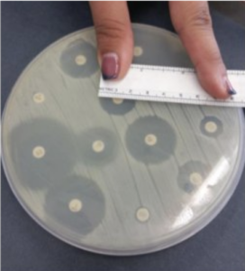 Zone of Inhibition explained