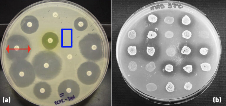 Zone of Inhibition explained