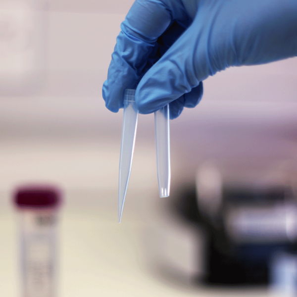 How do I pipette viscous liquids? - Singer Instruments